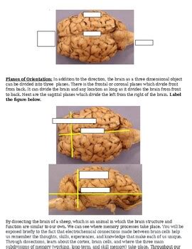Image result for Nervous System Dissection