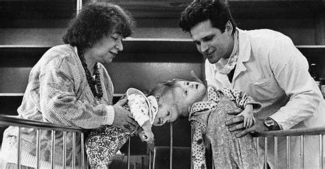 Image result for Java Island Siamese Twins