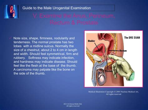 Image result for Urogram Exam