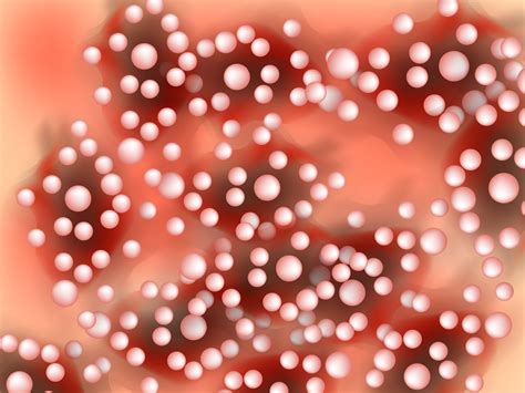 Image result for Types of Pustular Psoriasis