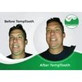 Image result for Temptooth Repair Instructions