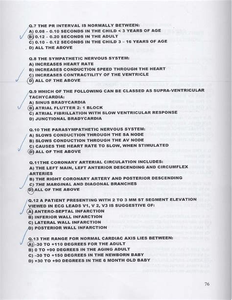 Image result for ECG Reading Practice
