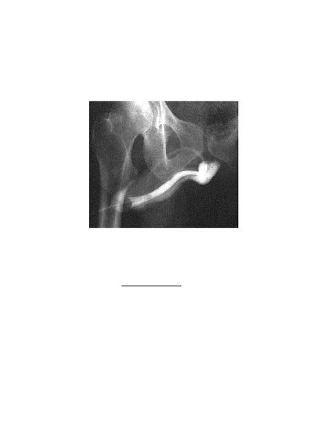 Image result for Urethrogram Technique