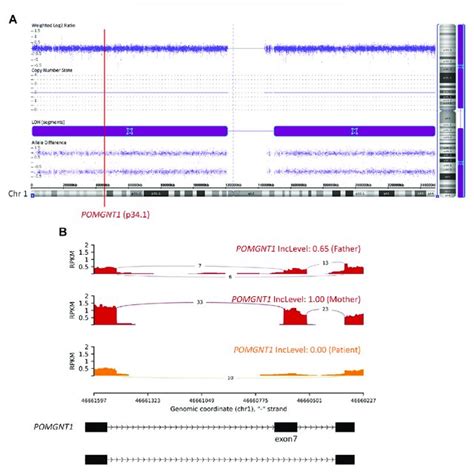 Image result for Chromosomal Microarray Procedure