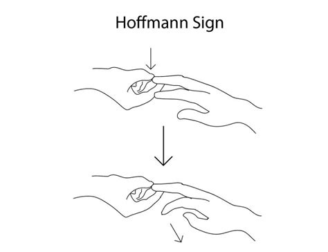 Image result for Tromner Sign vs Homner