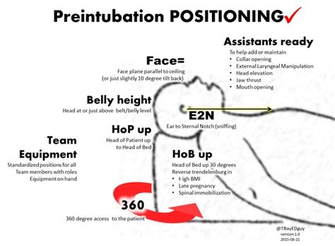 Image result for Intubation Position
