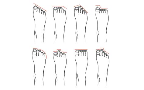 Image result for Different Types of Toes
