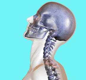 Image result for Computer Neck Pain