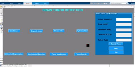 Image result for Python MATLAB Brain Surface