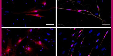 Image result for Neuronal Reprogramming