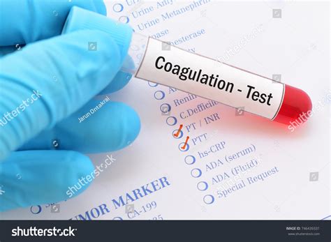 Image result for Blood Test Requisition Form