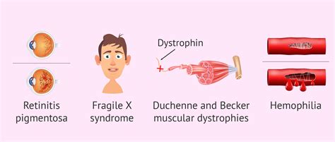 Image result for Types of Gender Disorders