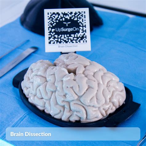 Image result for Brain Dissection