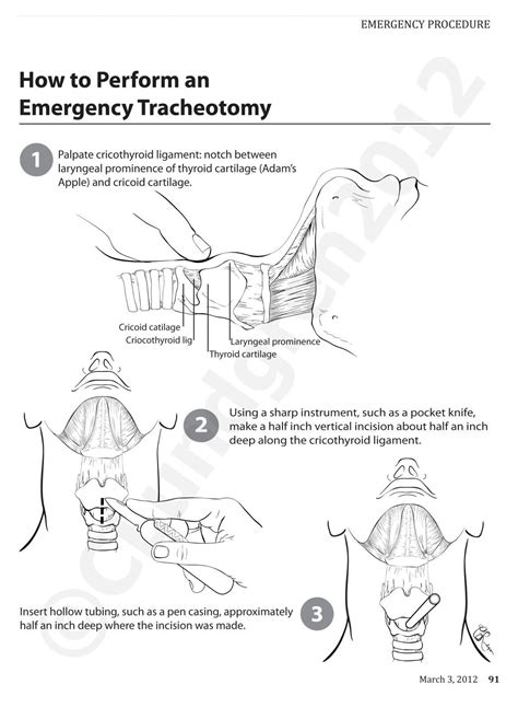Image result for Intubation Position