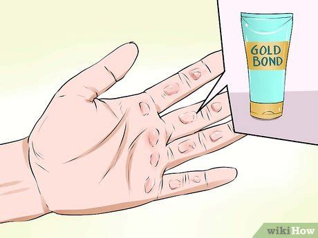 Image result for How to Remove Calluses From Hand