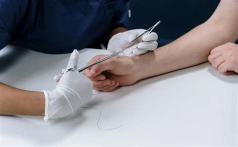 Image result for Hand Surgery Procedure