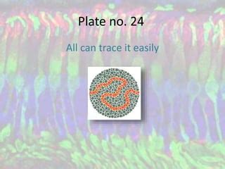 Image result for How to Perform Color Vision Test