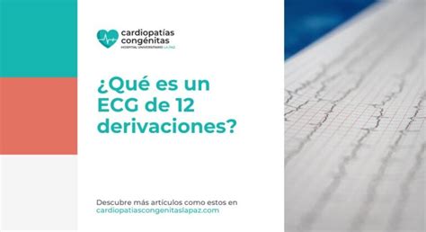 Image result for ECG 12 Derivaciones Normal