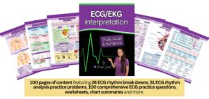 Image result for ECG Reading Practice