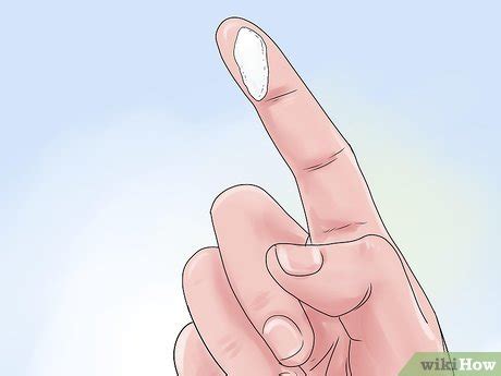 How to Remove a Splinter: 3 Removal Methods