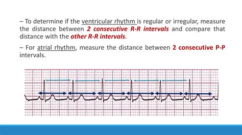 Image result for ECG Step by Step