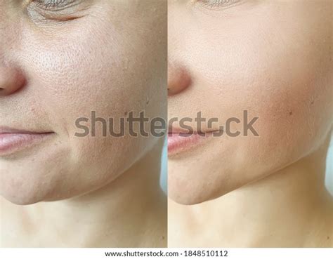 Image result for Back Neck Threading