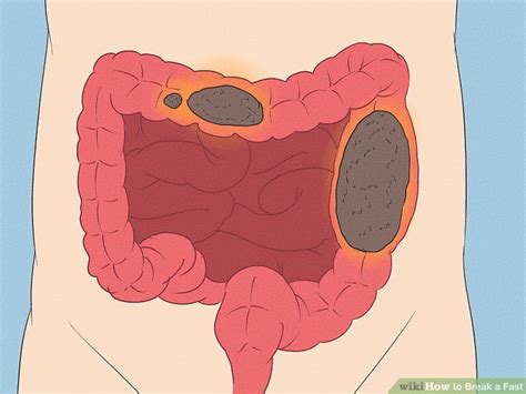 Image result for Breaking Prolong Fast