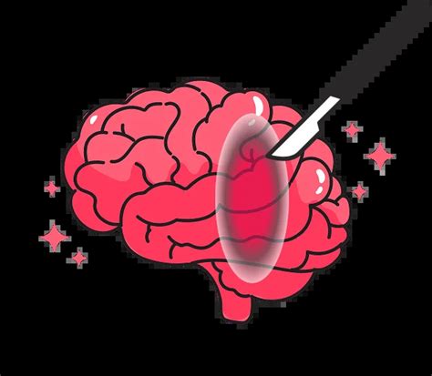 Image result for AVM Recovery