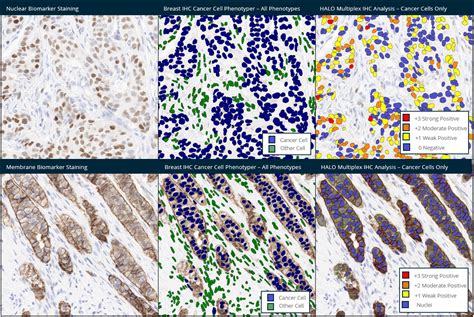 Image result for Tissue Microarray Multiplex IHC NCR