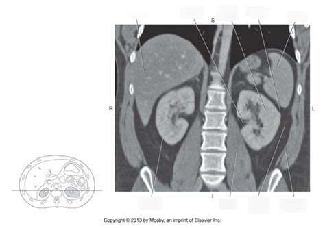 Image result for Nephrogram Phase Timing