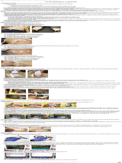 Image result for ECG 12 Derivaciones Normal