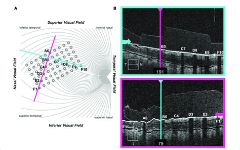 Image result for Oct Check