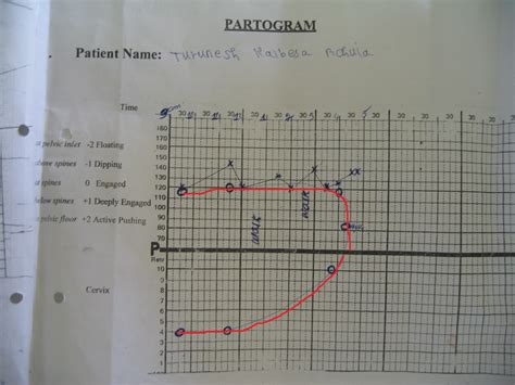 Image result for Partogram Design