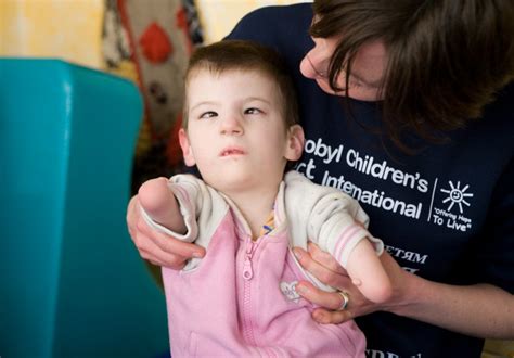 Image result for Birth Defects From Chernobyl Disaster