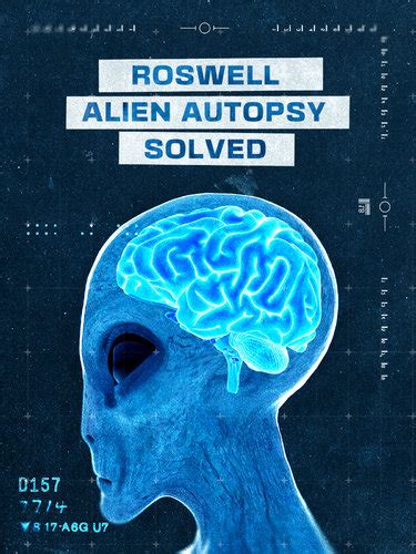 Image result for Alien Autopsy Film by Ray Santilli