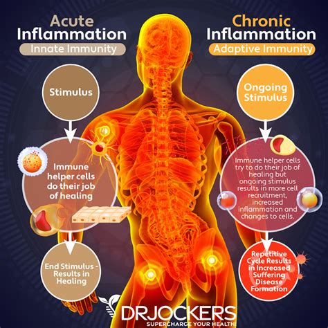 Image result for How to Reduce Inflammation Quickly