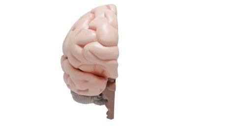 Image result for Human Brain Dissection