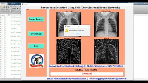 Image result for CNN Programming MATLAB