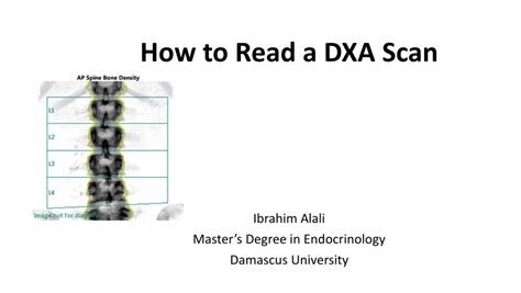 Image result for Using DXA
