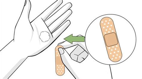 Image result for Drawing Ointment to Remove Splinter