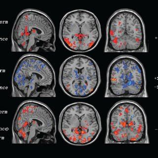 Image result for MicroScanner Result
