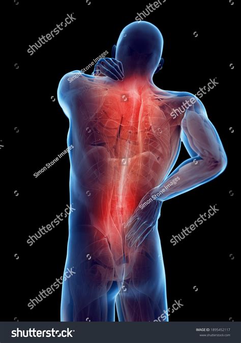 Image result for Back Pain in Computer