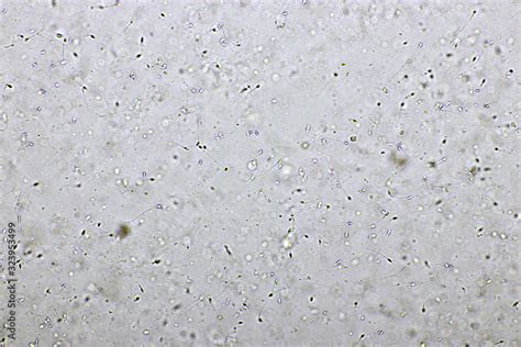 Image result for 400X Microscope