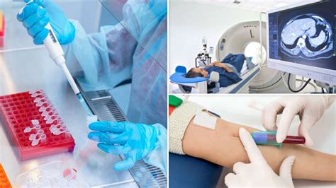 Image result for How Fast Can Lung Cancer Develop