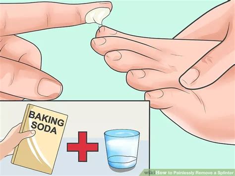 Image result for Drawing Ointment to Remove Splinter