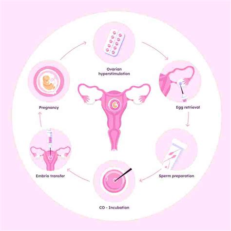 Image result for How Is IVF Done