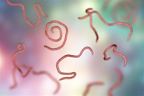 Image result for What Is Pinworm