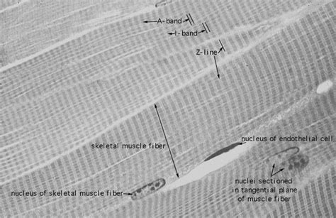 Image result for Patterning of Muscles