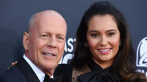 Image result for Chernobyl Disaster Human Body