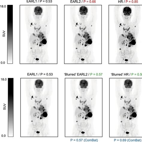 Image result for MIP Training